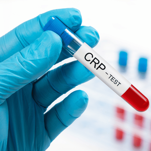 CRP érték - Kardioközpont